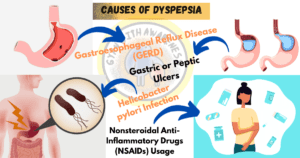 Dyspepsia Icd 10 Code, Causes, Symptoms, And Best Treatment